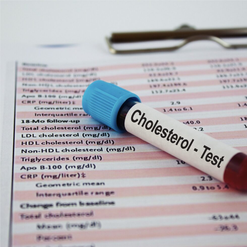 Understanding Cholesterol | EnerQi Health